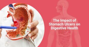 Stomach Ulcers on Digestive Health: Symptoms & Prevention